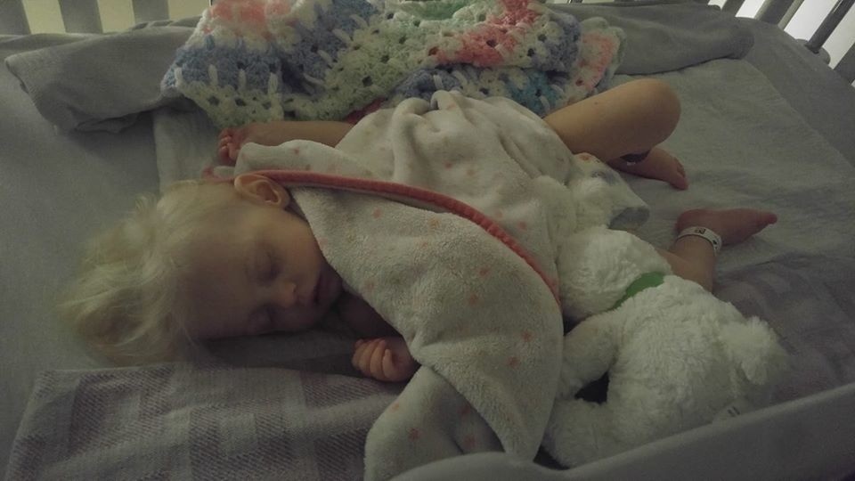 Milk Babies Syndrome Anemia