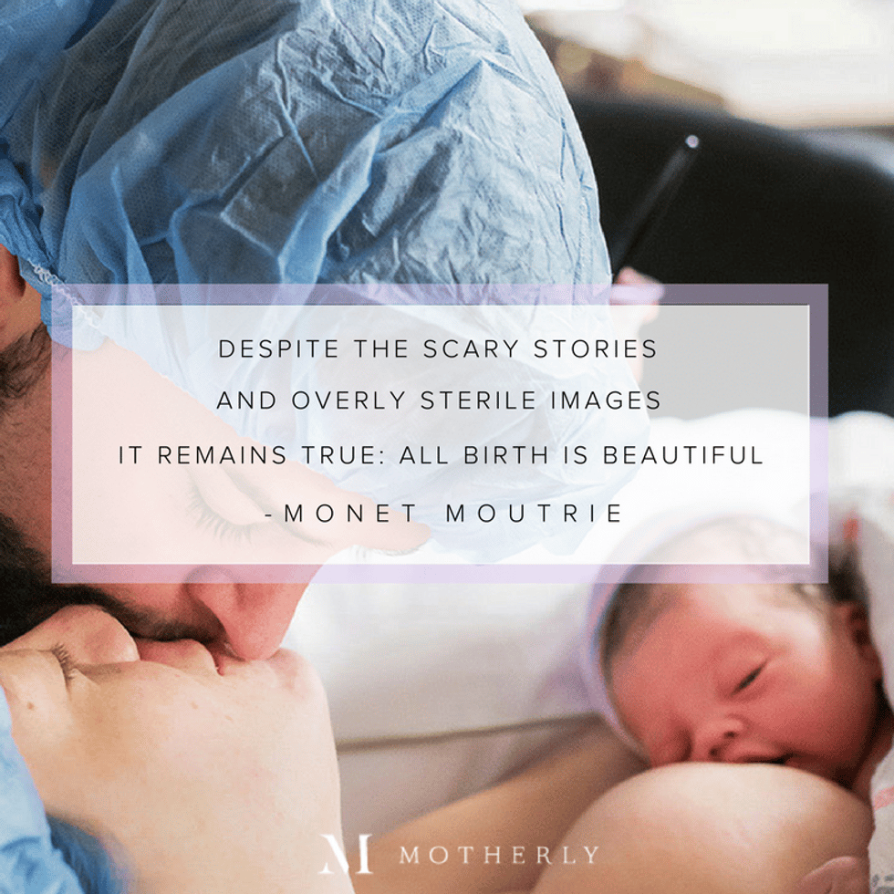 Believe it, baby: All birth is beautiful